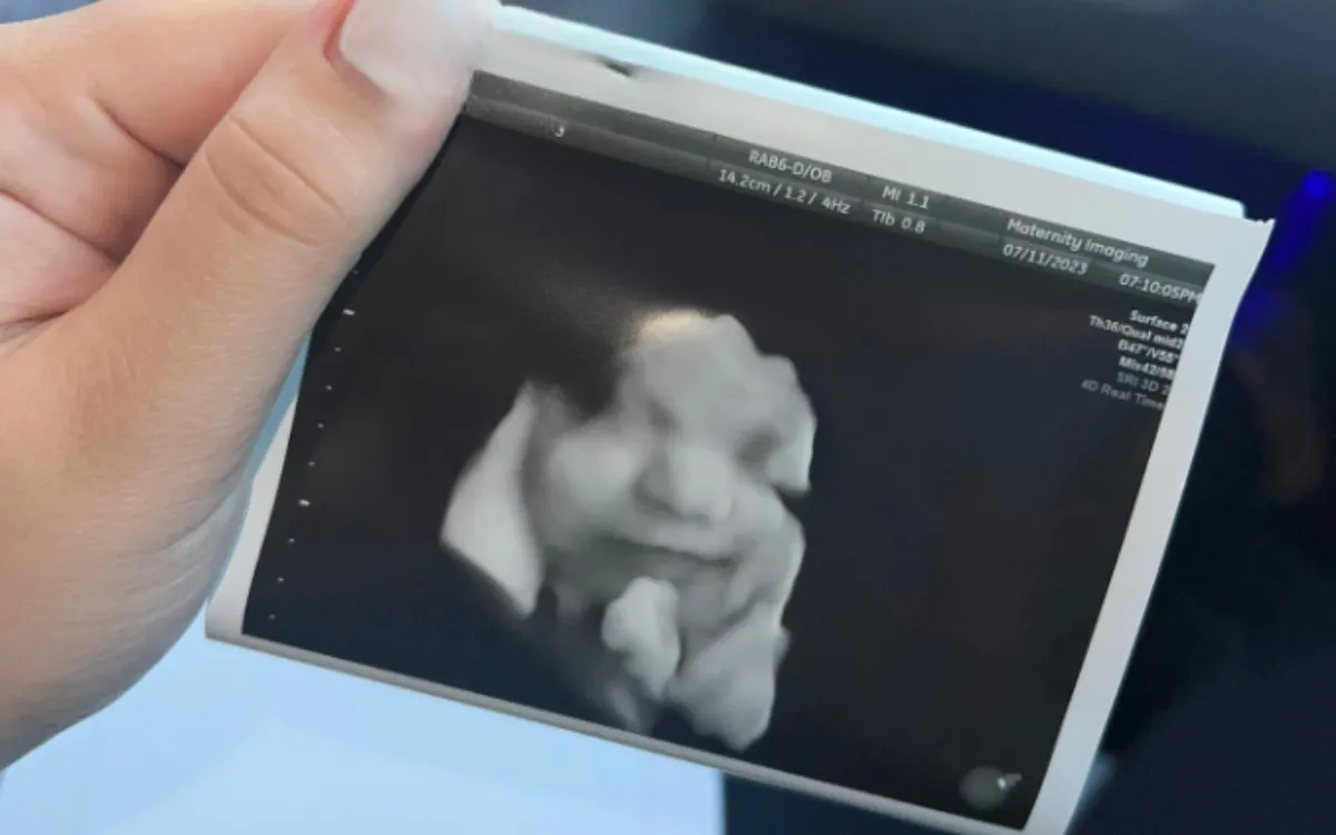 Baby News & Latest Pictures From Newsweek.com