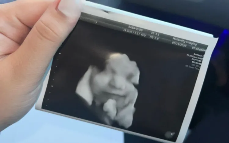 Mom-To-Be Gets Crushing News During Scan, 3 Weeks Later Everything ...