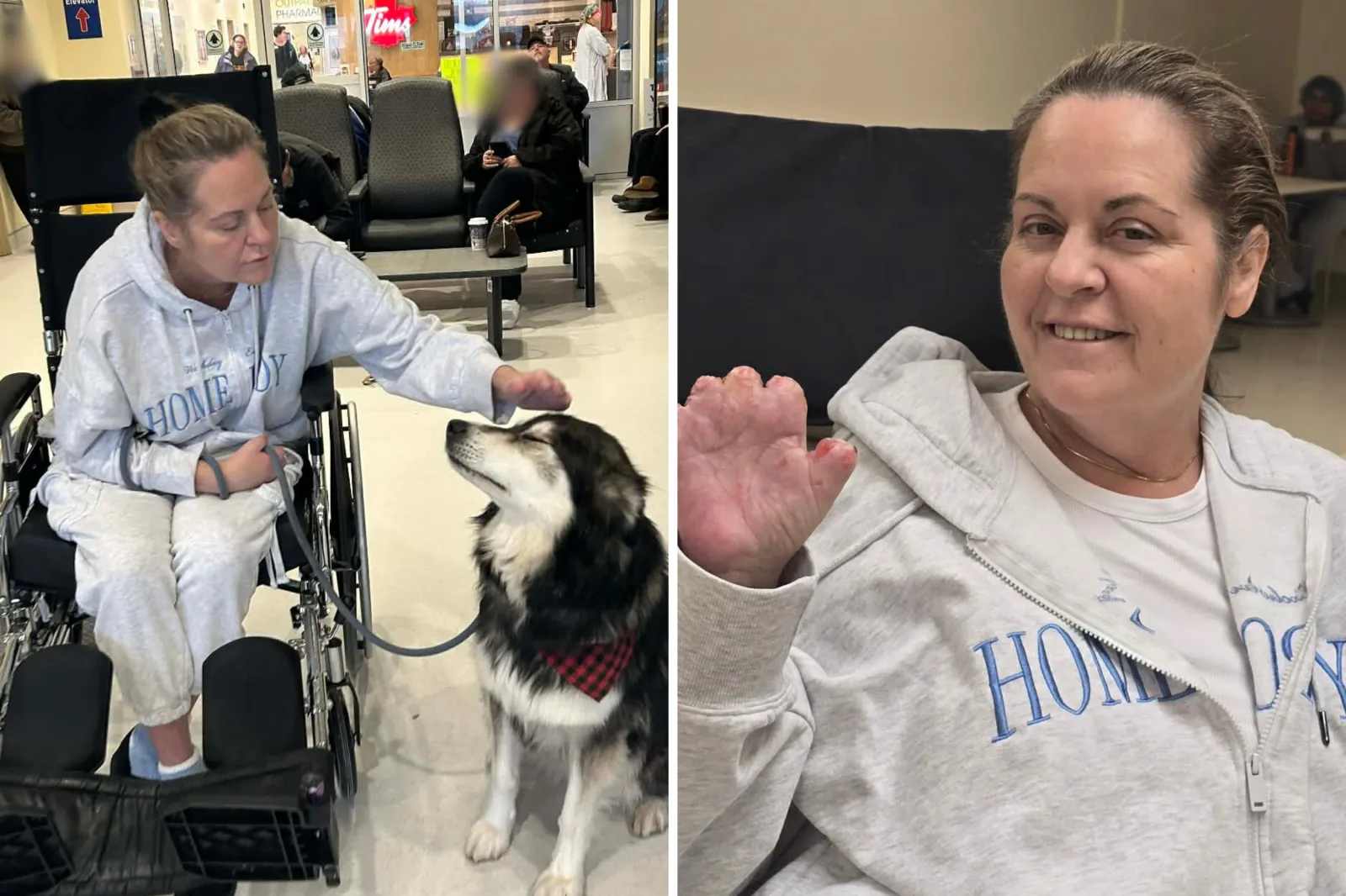 Four Months, 20 Amputations—What Happened After My Surgery Went Wrong ...