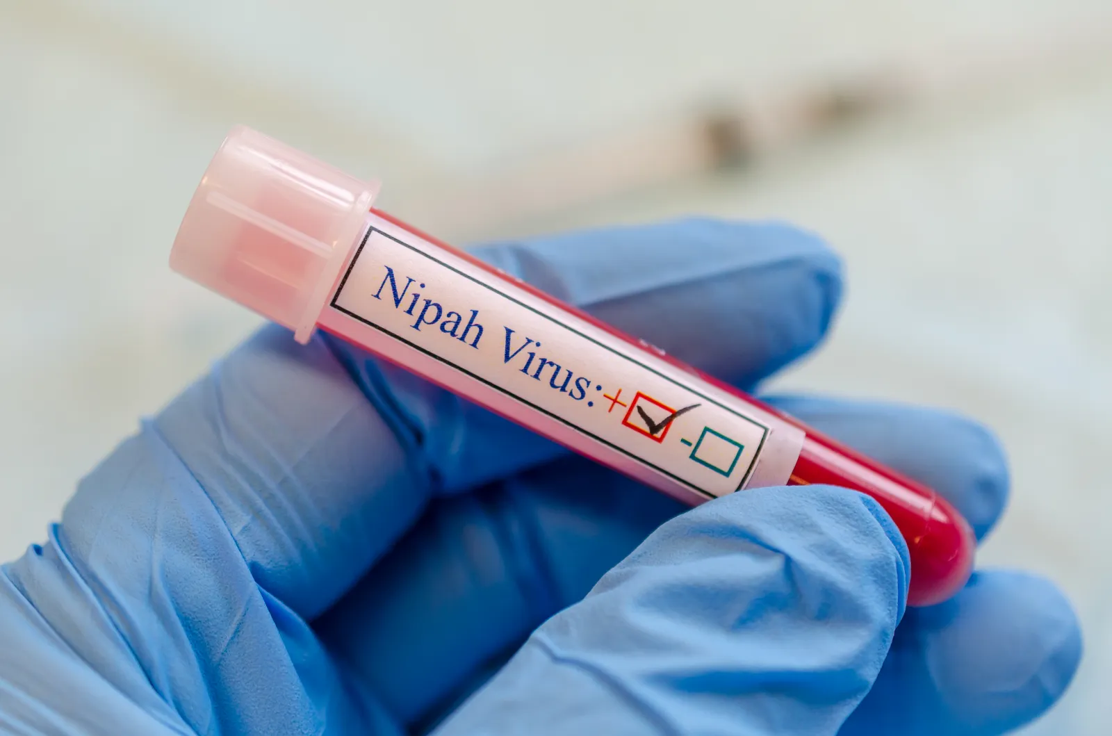 Nipah Virus Outbreak: Global Virus Network Issues Statement - Newsweek
