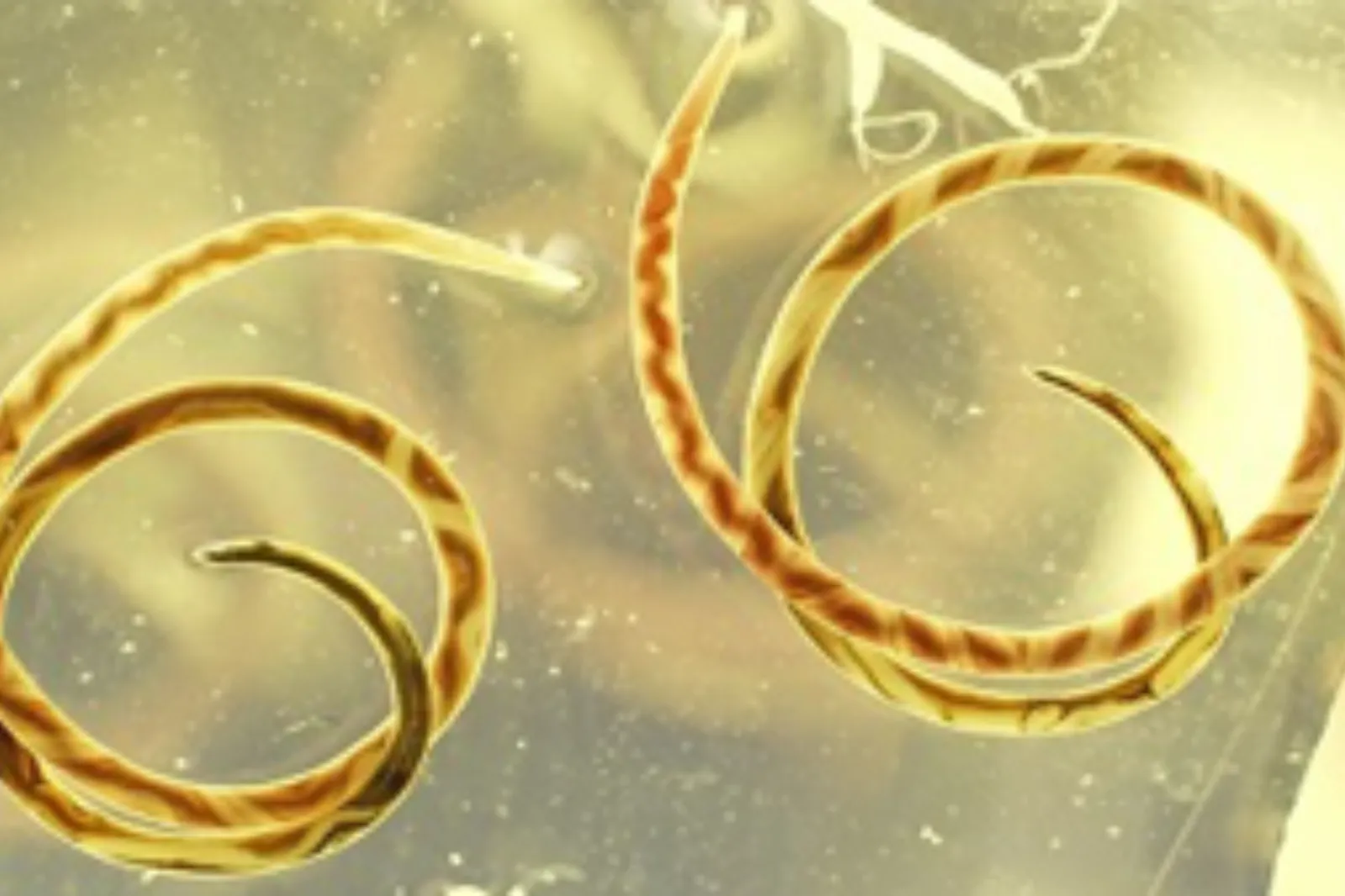 Rat Lungworm Is in California—How Does it Affect Humans? - Newsweek