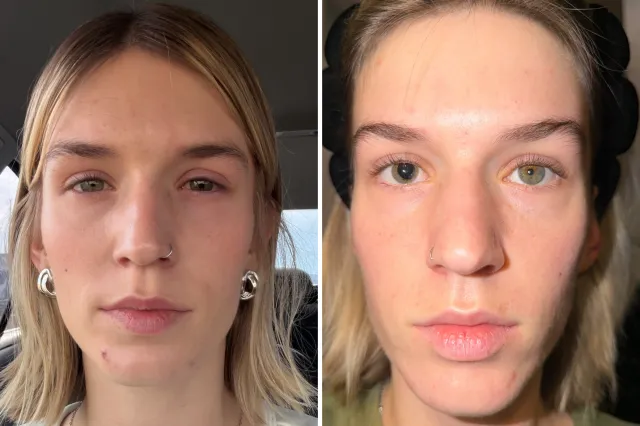 Woman Hit in Eye by Nerf Gun While Babysitting—Here’s What Happened ...