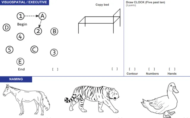 Trump Got a ‘Perfect’ Score On His Cognitive Test—How Do You Compare ...